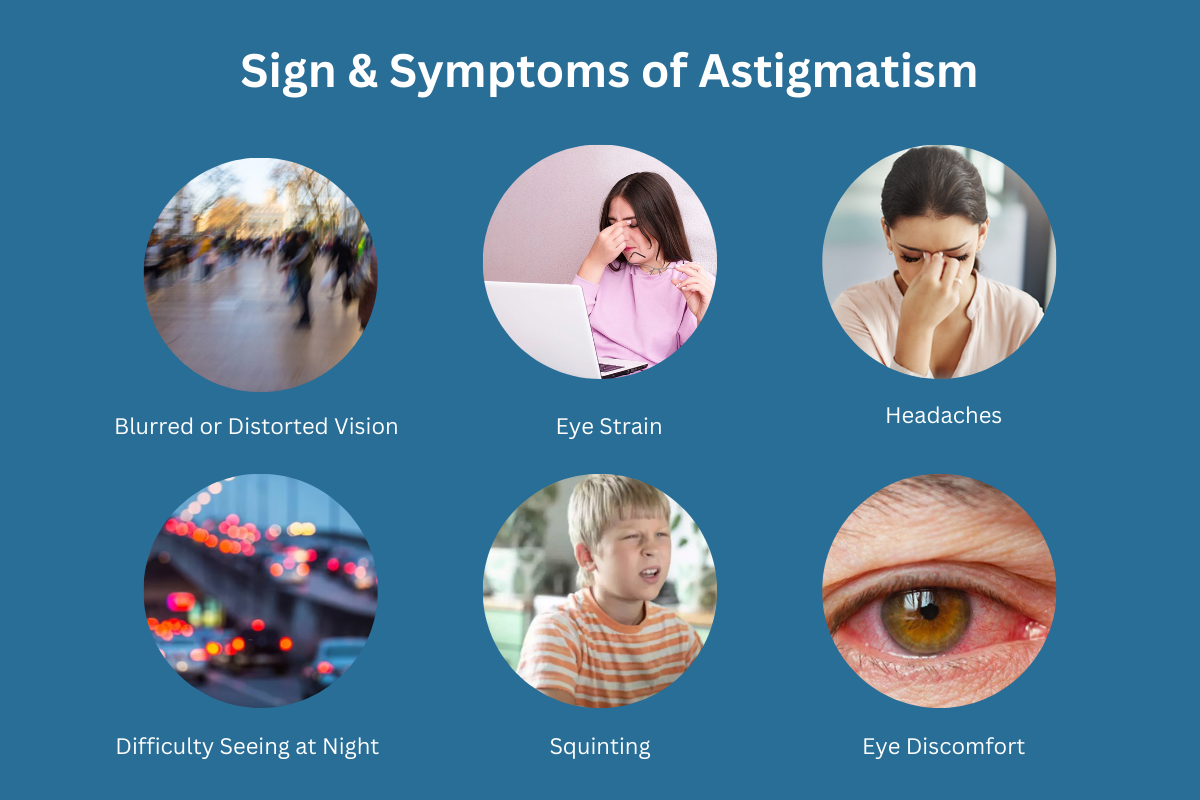 Astigmatism: Symptoms, Causes, Diagnosis and Treatment Guide