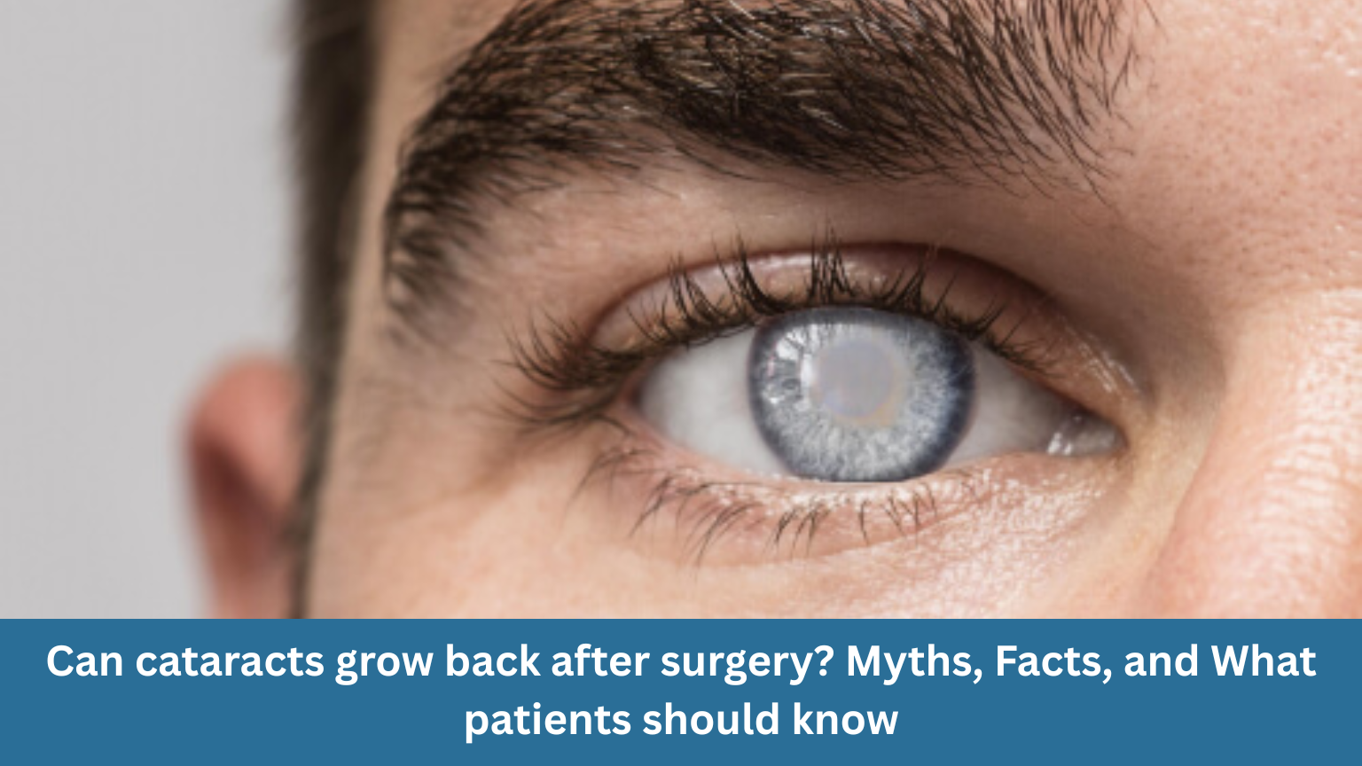 Can Cataracts Grow Back After Surgery? Myths & Facts